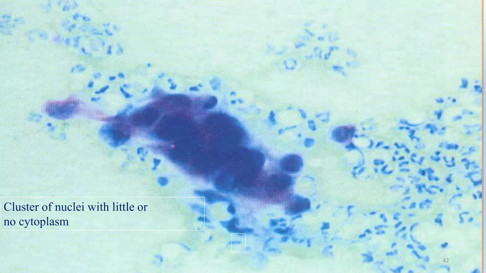 Exfoliative cytology | PPTX