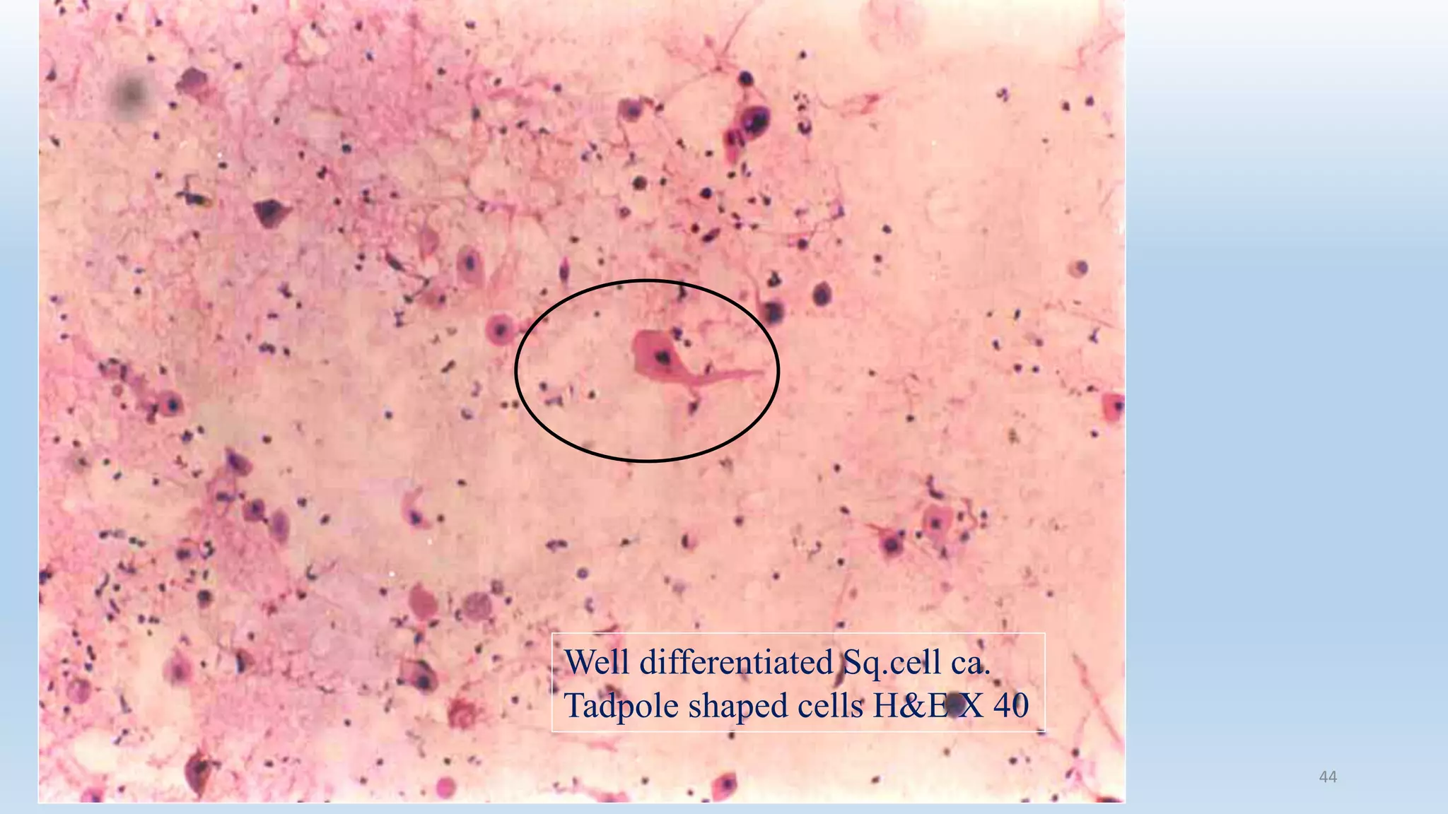 Exfoliative cytology | PPTX
