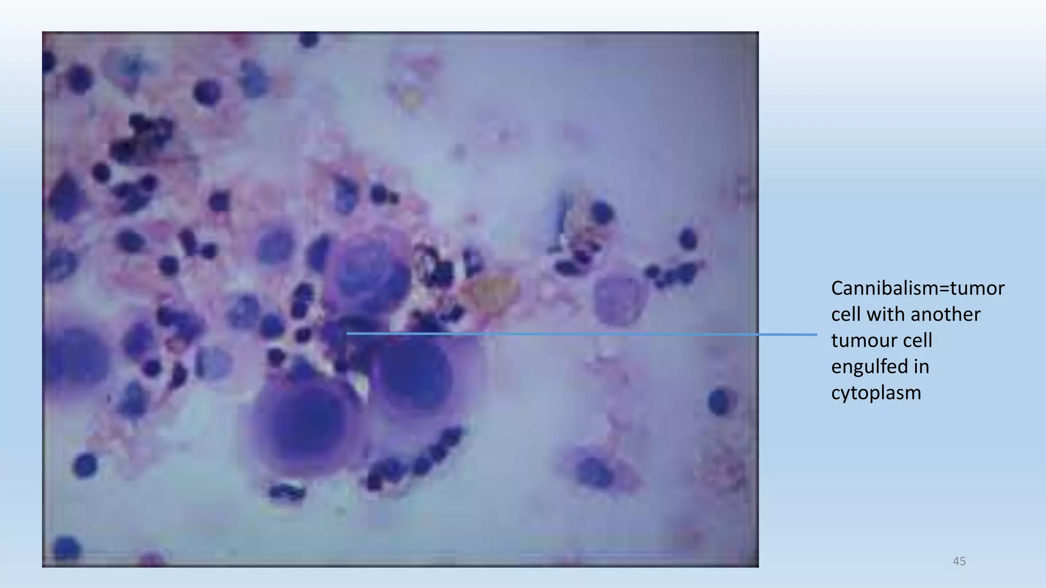 Exfoliative cytology | PPTX