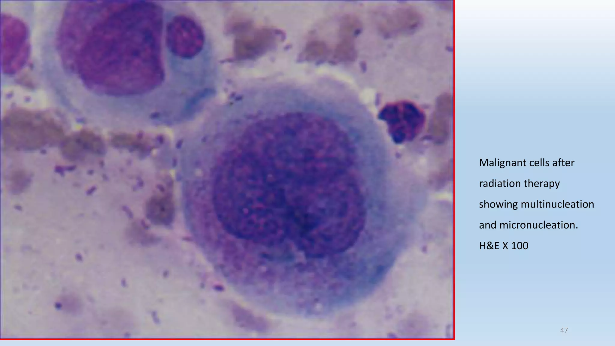 Exfoliative cytology | PPTX