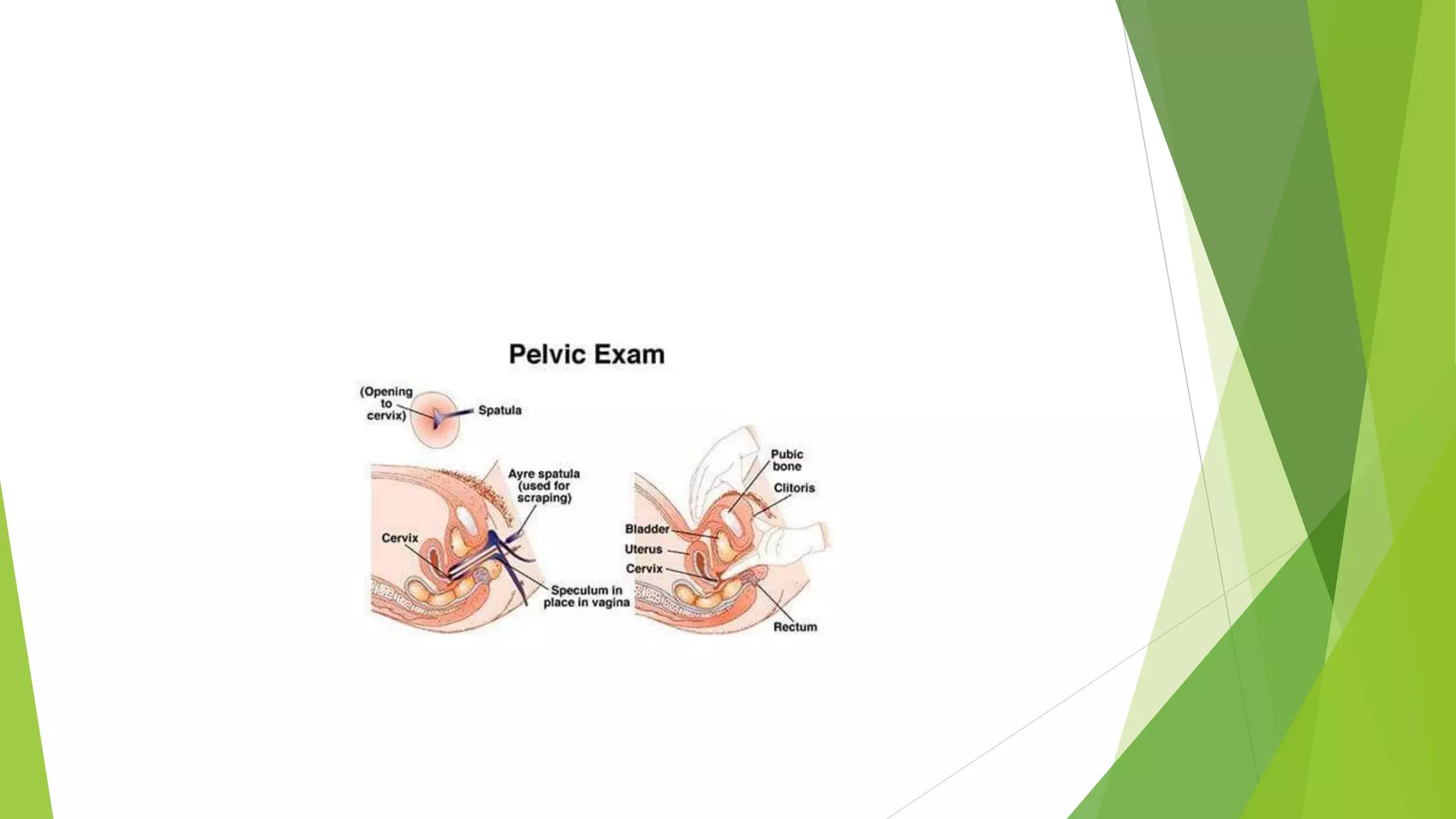 Exfoliative cytology | PPTX