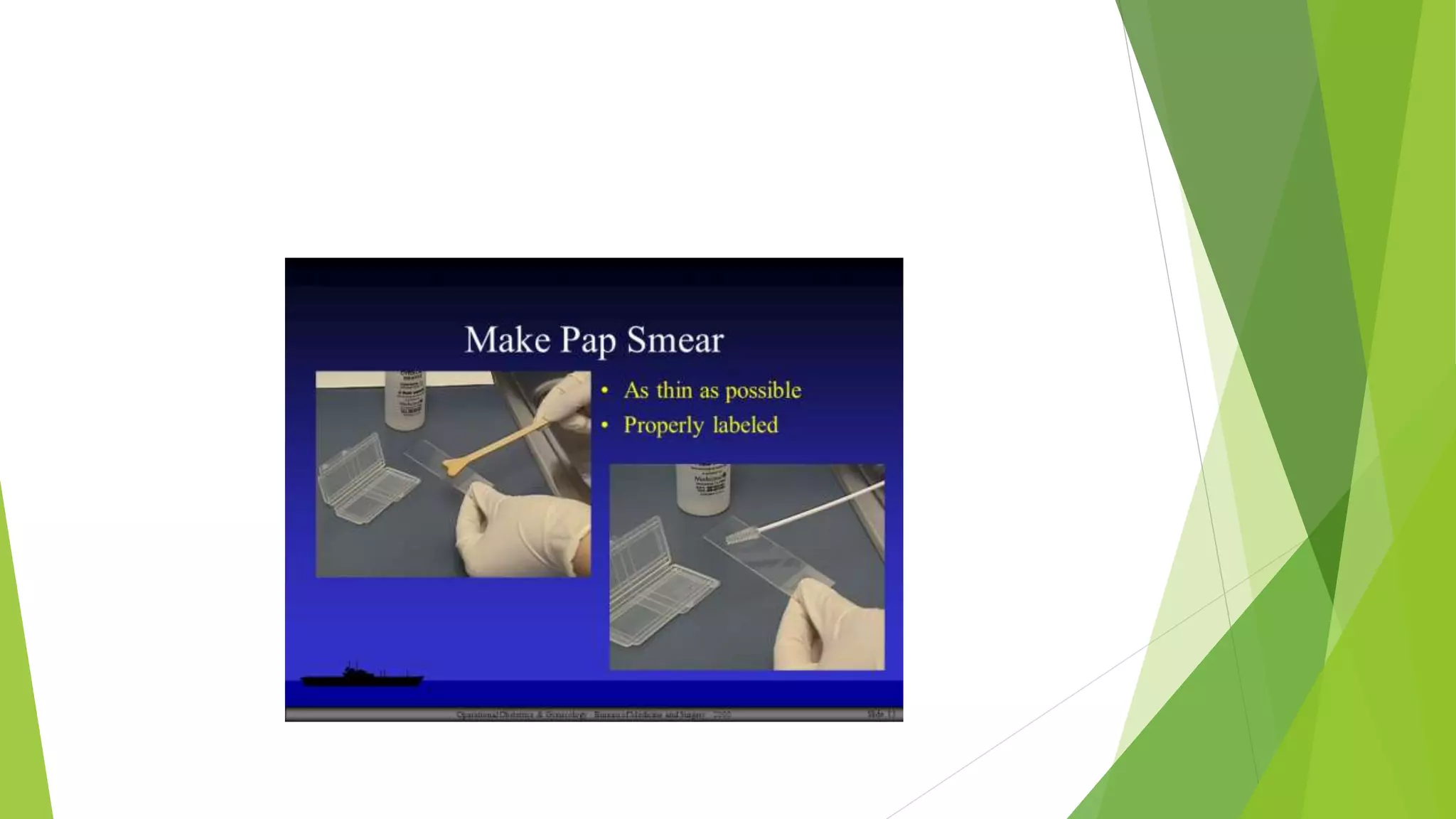 Exfoliative cytology | PPTX