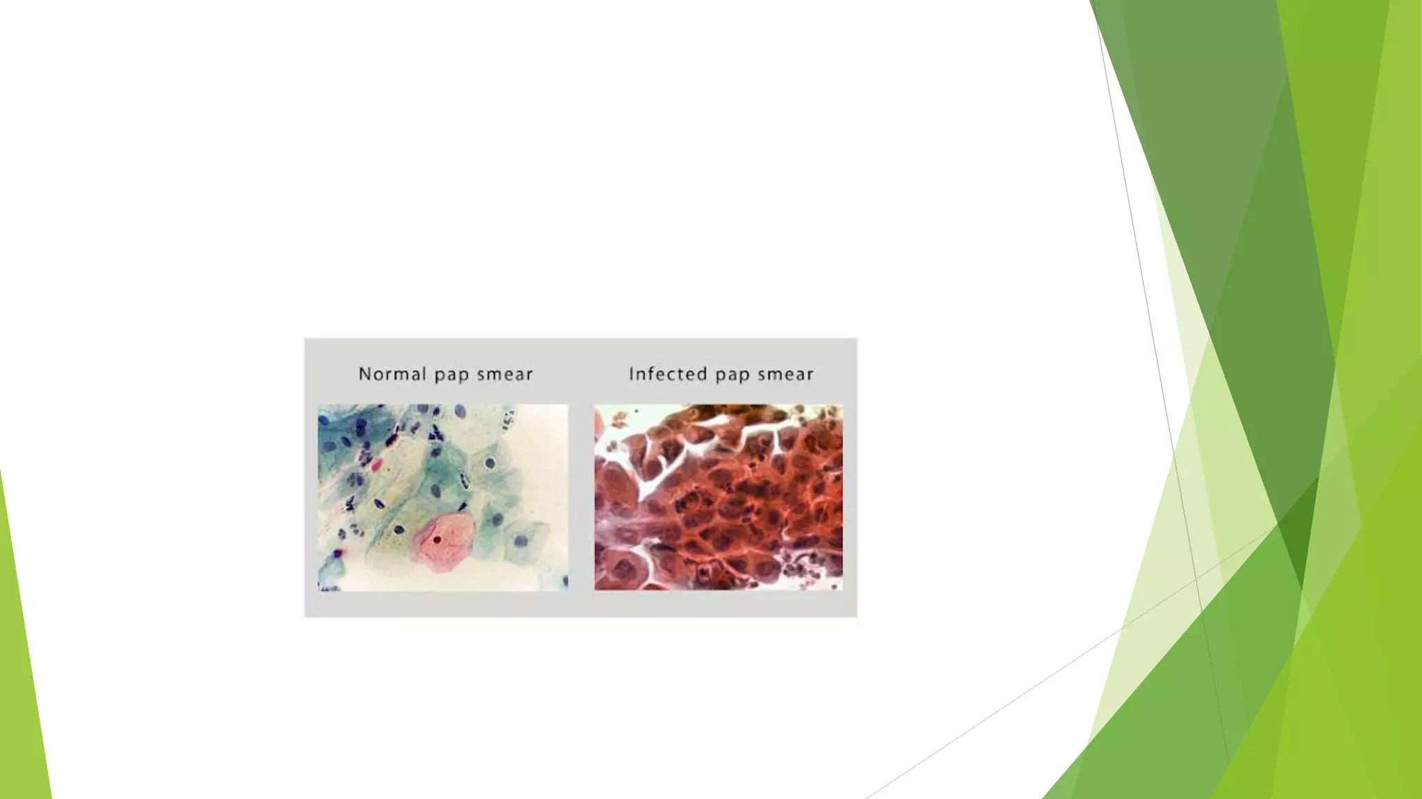 Exfoliative cytology | PPTX