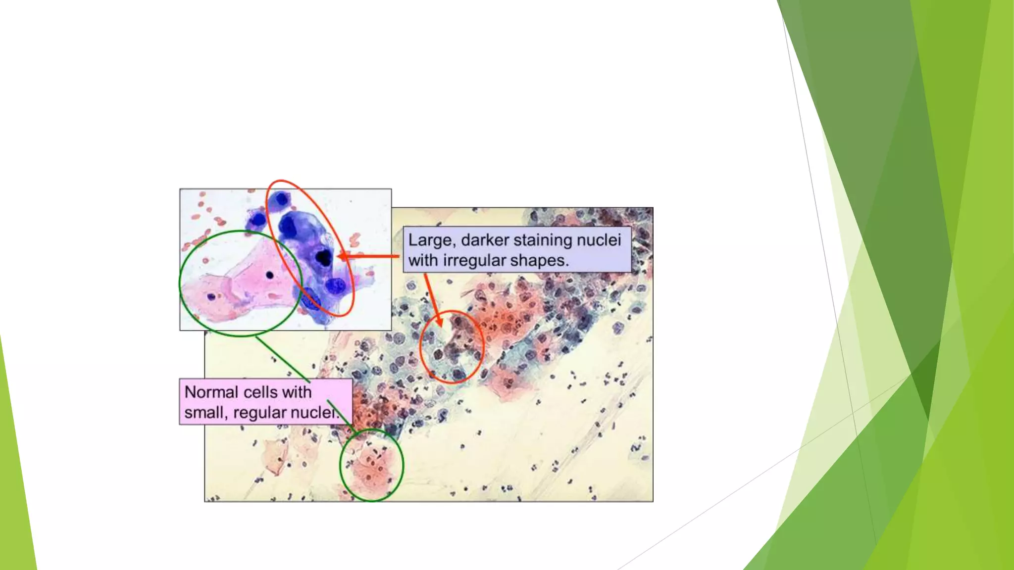 Exfoliative cytology | PPTX