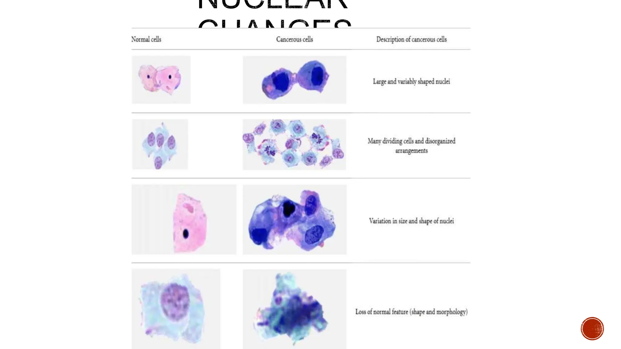 EXFOLIATIVE CYTOLOGY , ORAL CYTOSMEAR, ORAL CYTOLOGY | PPTX