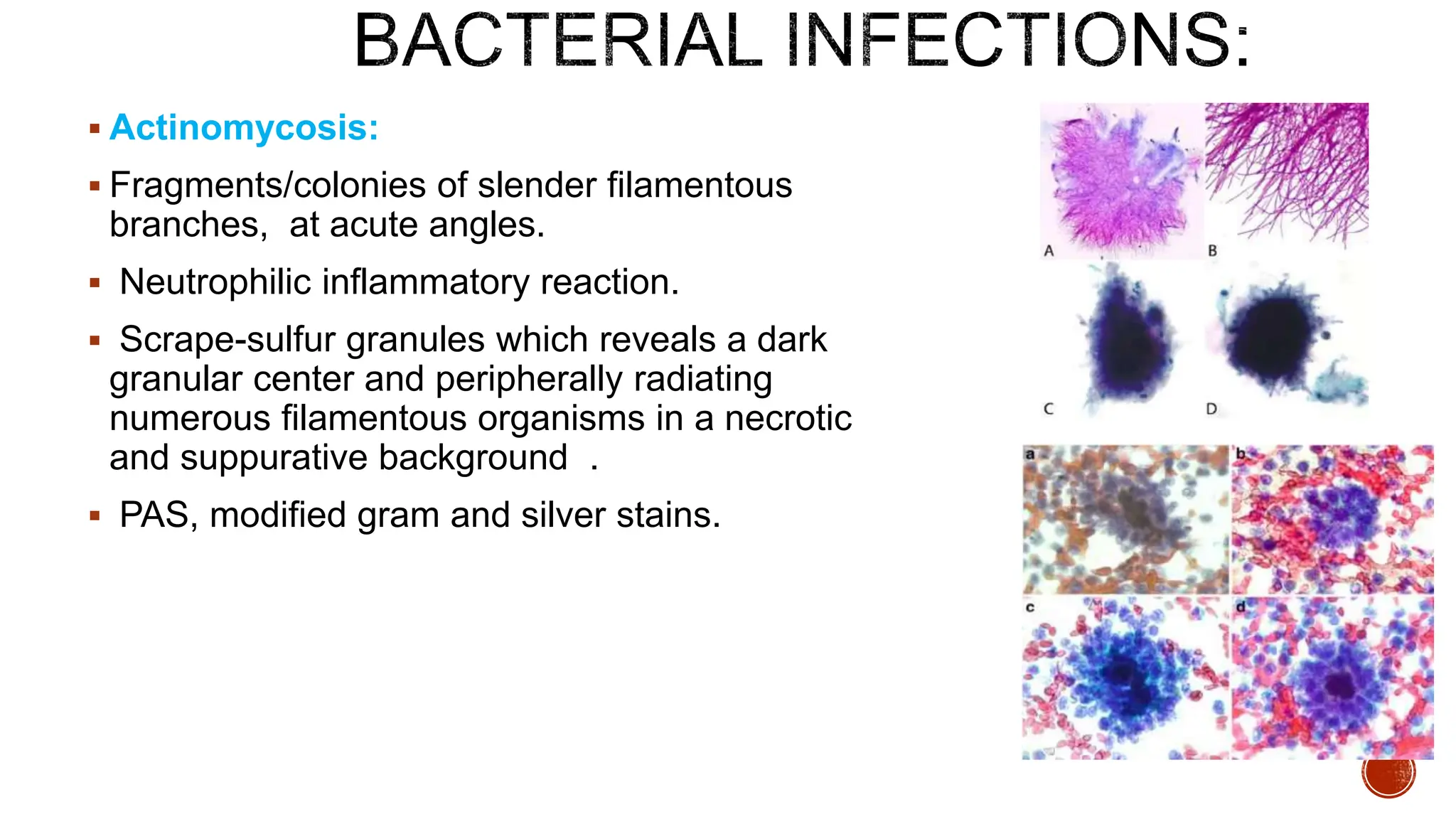 EXFOLIATIVE CYTOLOGY , ORAL CYTOSMEAR, ORAL CYTOLOGY | PPTX