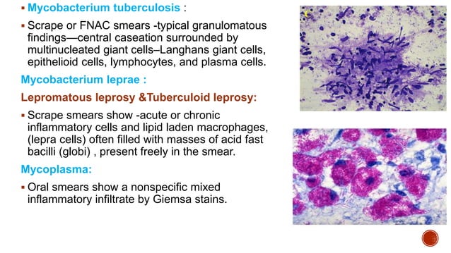 EXFOLIATIVE CYTOLOGY , ORAL CYTOSMEAR, ORAL CYTOLOGY | PPTX | Dental ...
