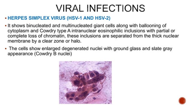 EXFOLIATIVE CYTOLOGY , ORAL CYTOSMEAR, ORAL CYTOLOGY | PPTX | Dental ...