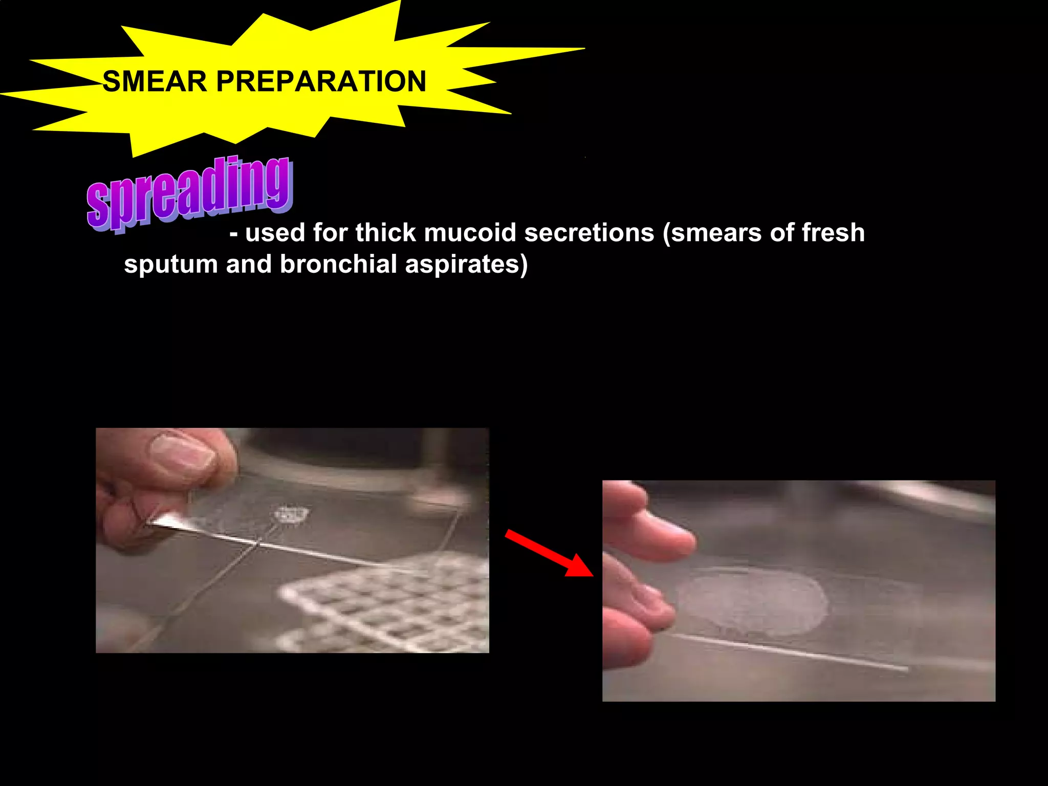 Exfoliative cytology | PPT