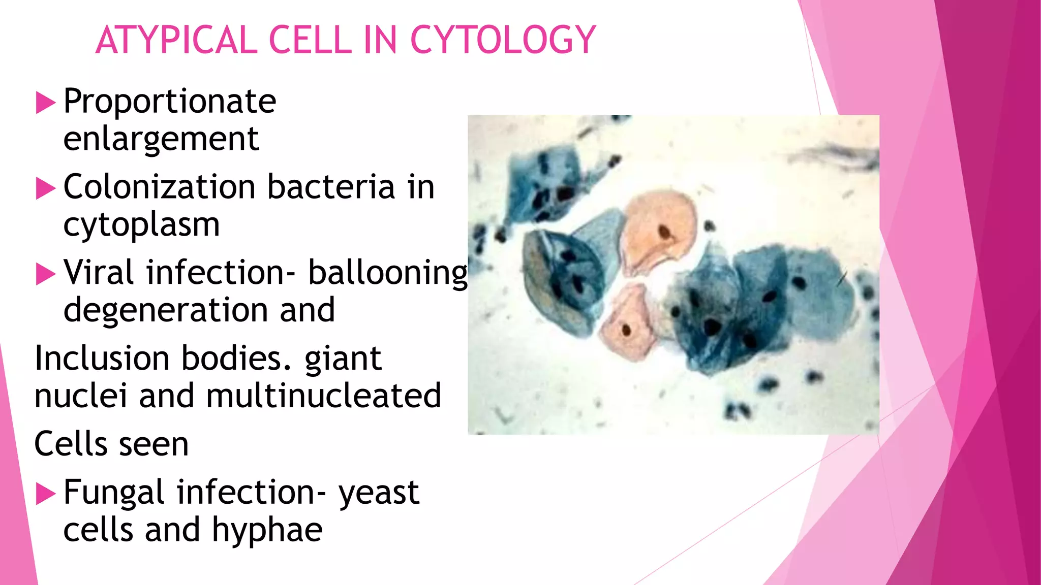 Exfoliative cytology for dental students | PPTX
