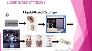 Exfoliative cytology for dental students | PPTX