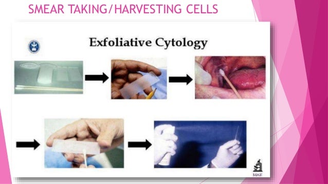 Exfoliative cytology for dental students