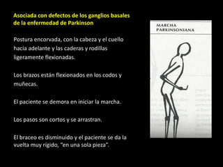 Ex fx neurologico | PPTX
