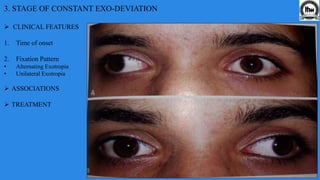 Exo-Deviations | PPTX