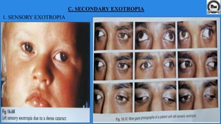 Exo-Deviations | PPTX