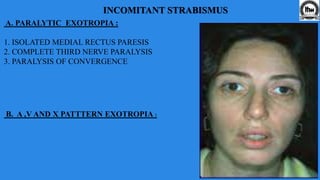 Exo-Deviations | PPTX