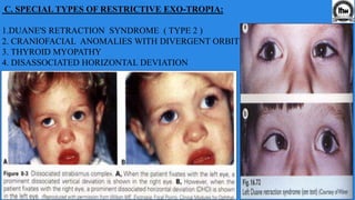 Exo-Deviations | PPTX