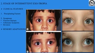 Exo-Deviations | PPTX