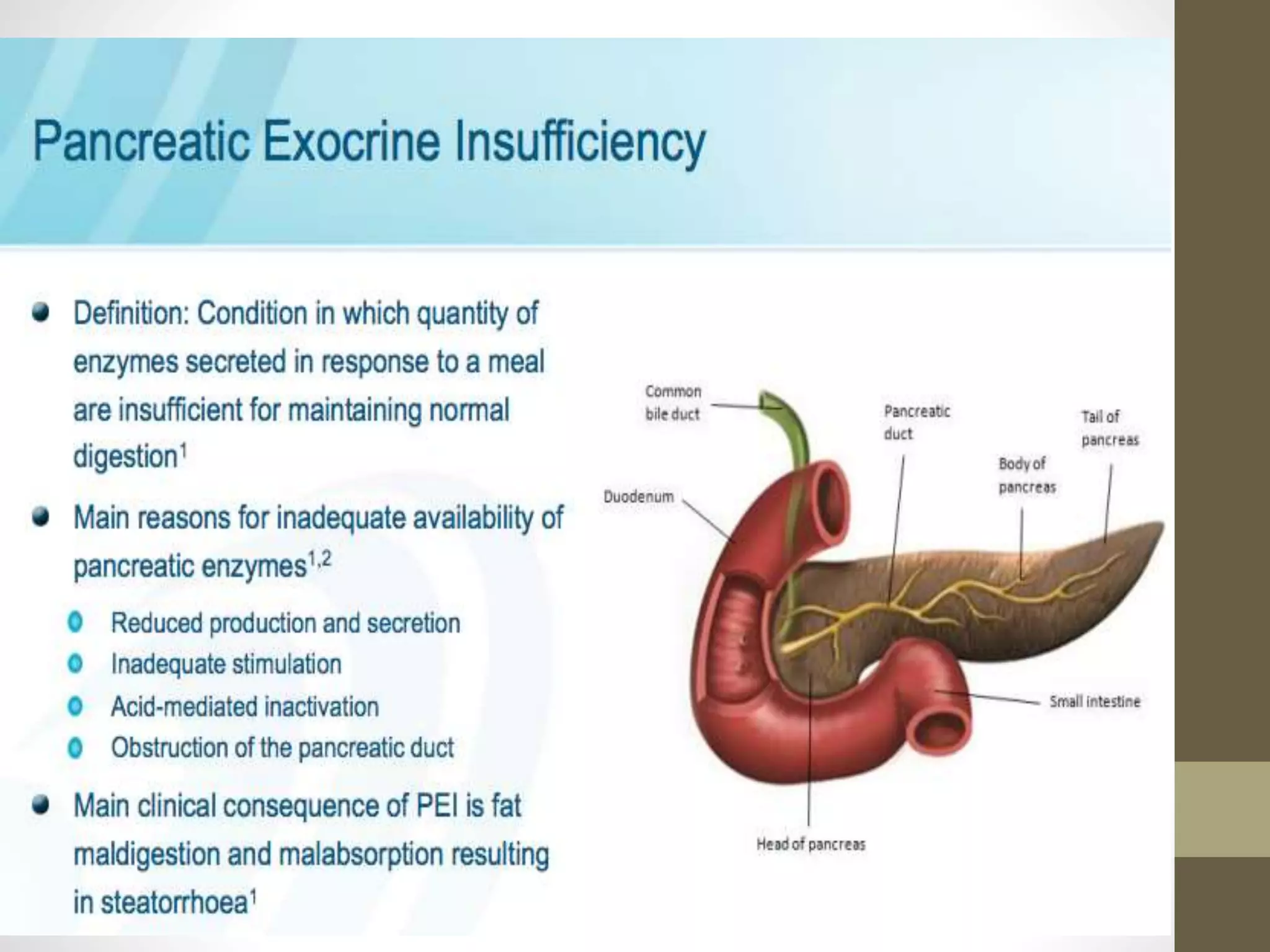Exocrine pancreatic insufficiency - Dr Shaz Pamangadan | PPTX