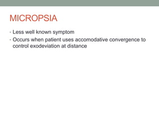 Exodeviations | PPTX