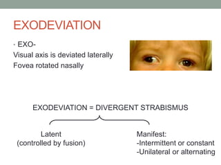 Exodeviations | PPTX