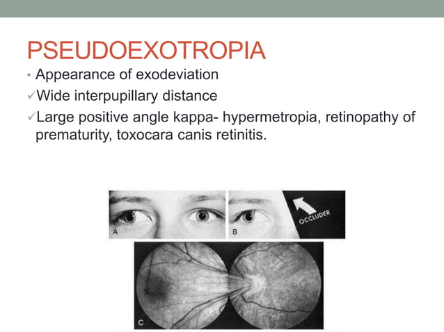 Exodeviations | PPTX