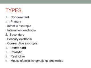 Exodeviations | PPTX