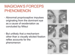 Exodeviations | PPTX