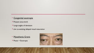 exodeviations.presention................ | PPTX