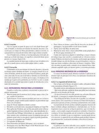 Exodoncia.pdf