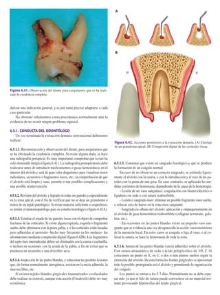 Exodoncia.pdf