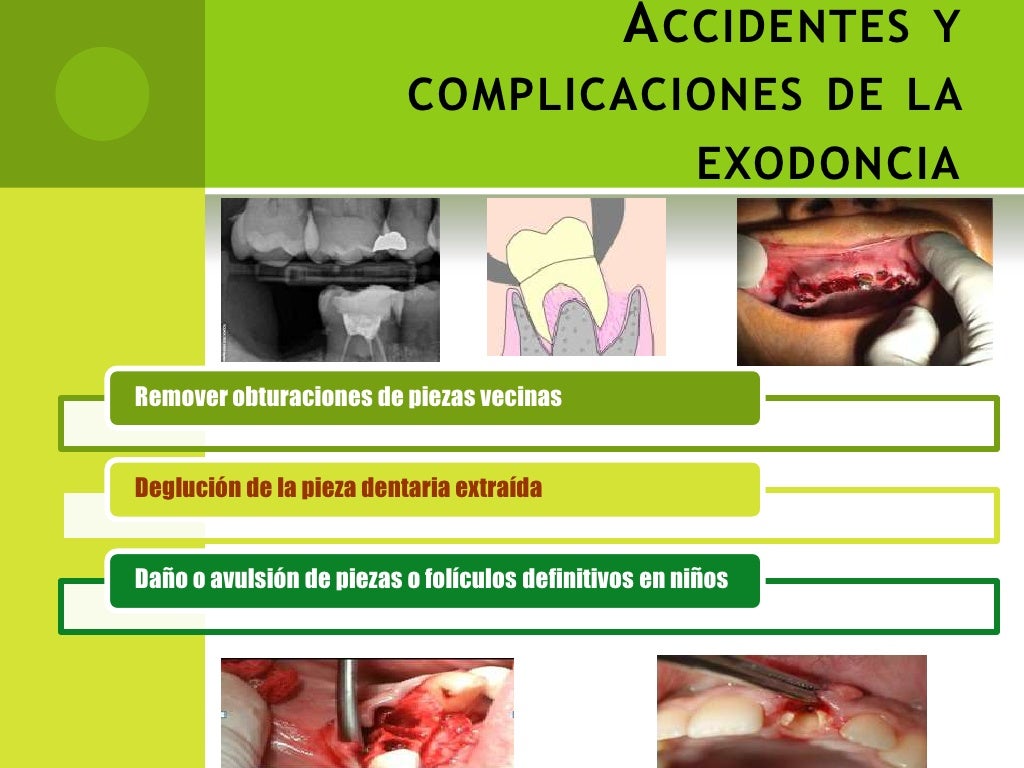 Accidentes Y Complicaciones De La Exodoncia Coggle Di - vrogue.co Accidentes Y Complicaciones De La Exodoncia Coggle Di - vrogue.co