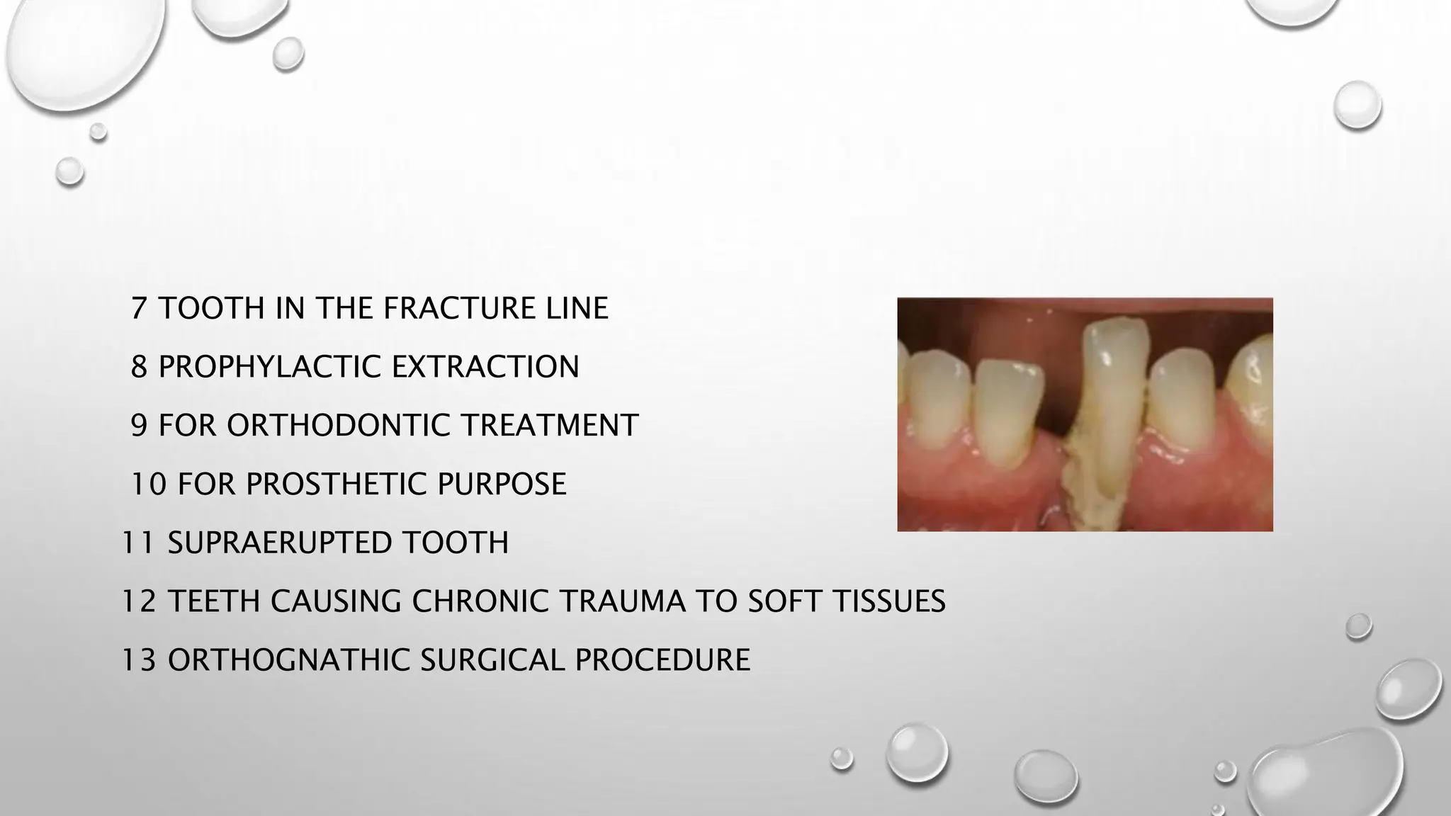Detailed power point presentation on the topic Exodontia of oral and ...