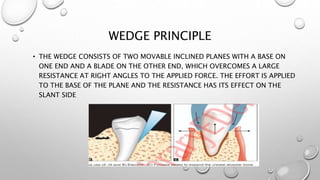 Detailed power point presentation on the topic Exodontia of oral and ...