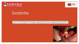 Exodontia presentation in dentistry pdff | PDF