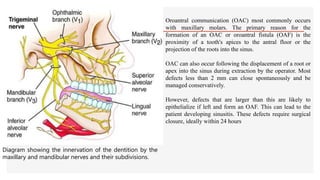 Exodontia presentation in dentistry pdff | PDF