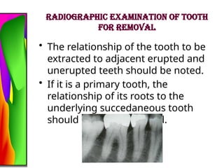 EXODONTIA technique and principles of tooth extraction | PPTX