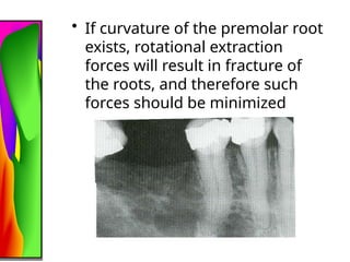 EXODONTIA technique and principles of tooth extraction | PPTX