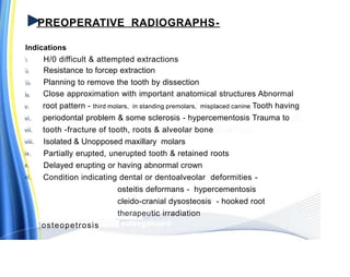 exodontia-ppt.pptx