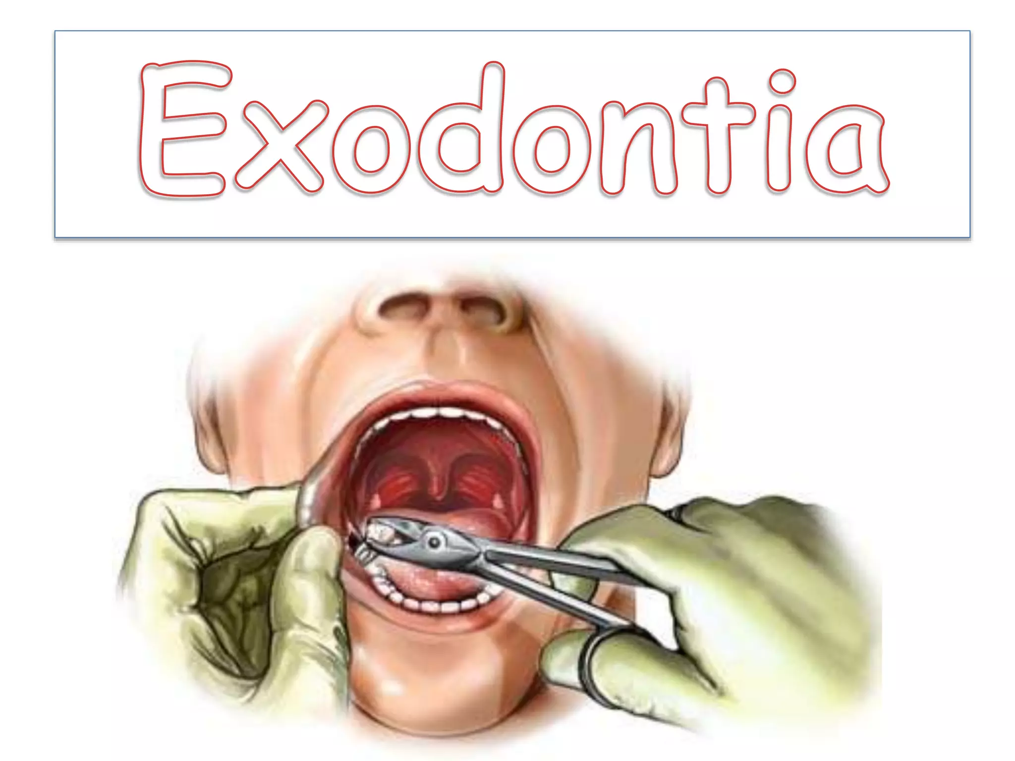 Exodontia | PPTX