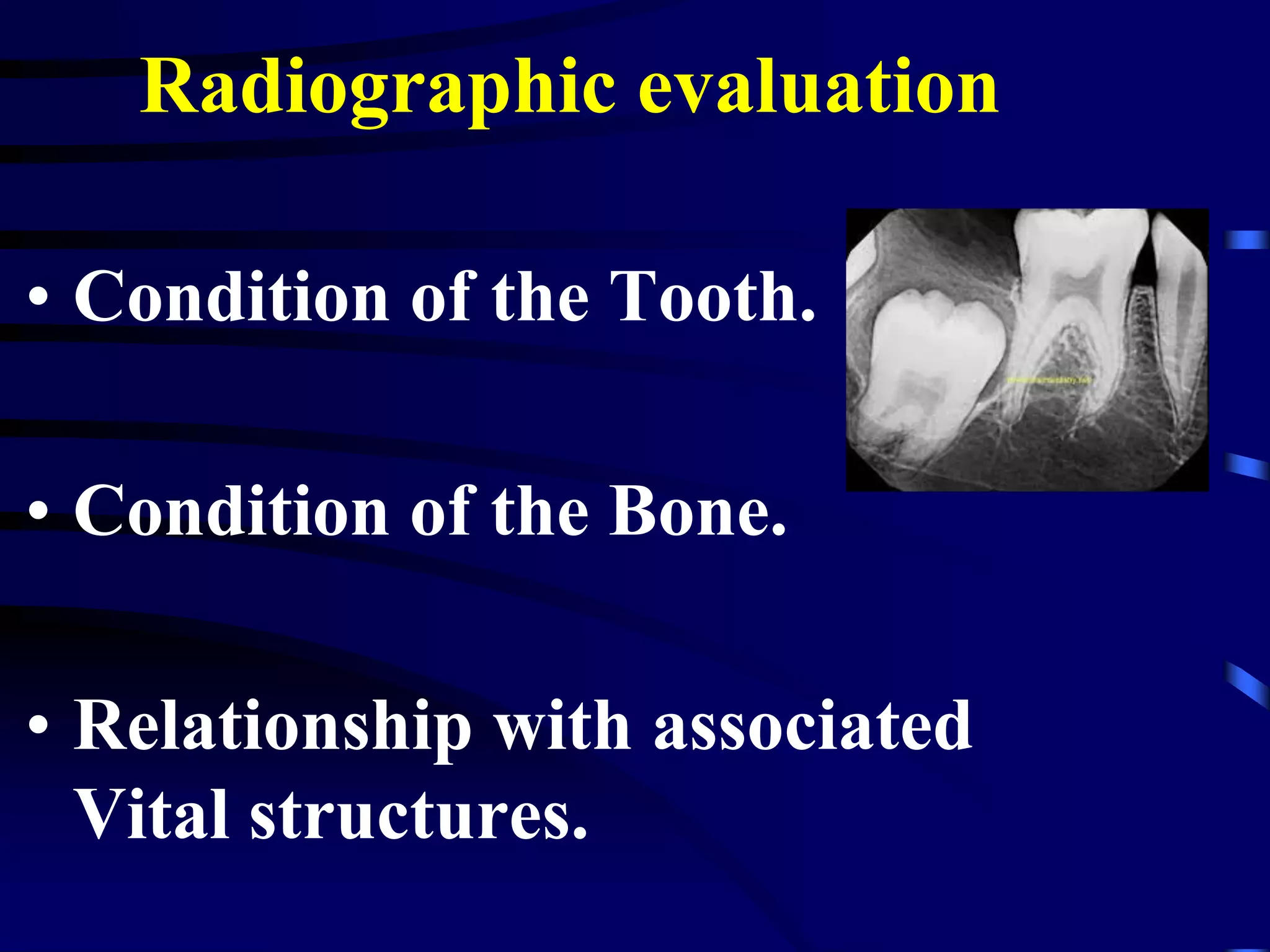 Principles of Exodontia (teeth extraction) by Dr., Giath Gazal, 2020 | PDF
