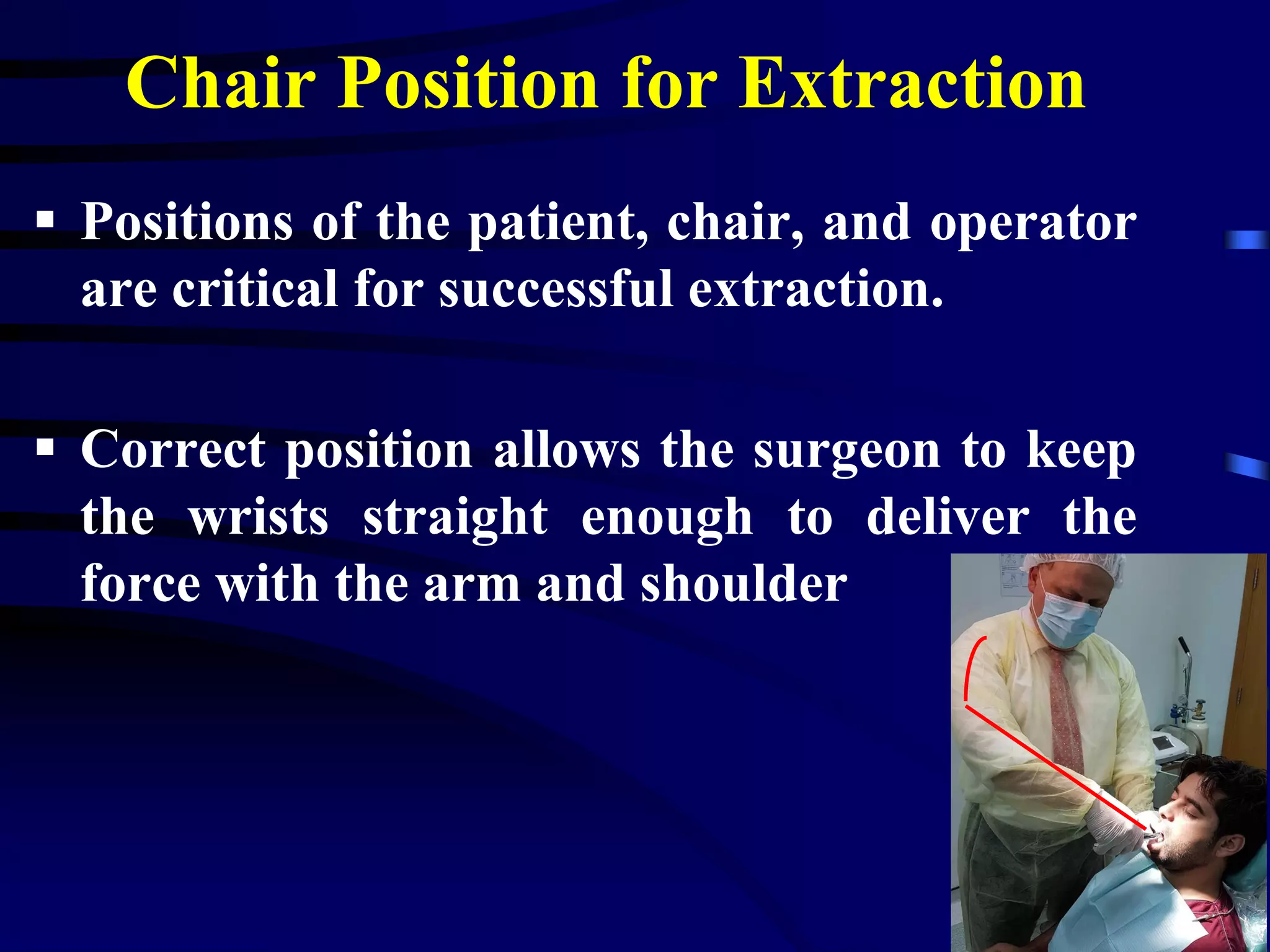 Principles of Exodontia (teeth extraction) by Dr., Giath Gazal, 2020 | PDF