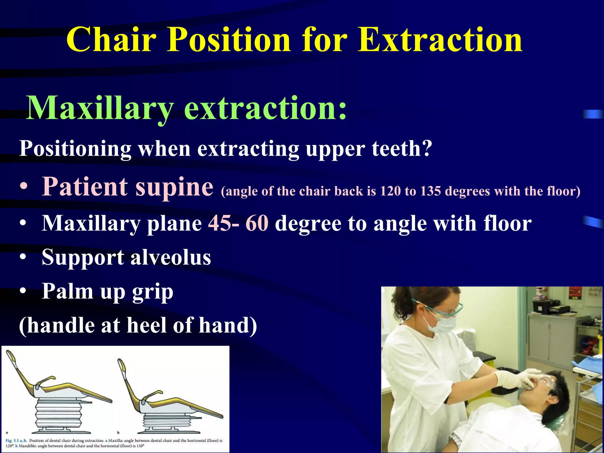 Principles of Exodontia (teeth extraction) by Dr., Giath Gazal, 2020 | PDF