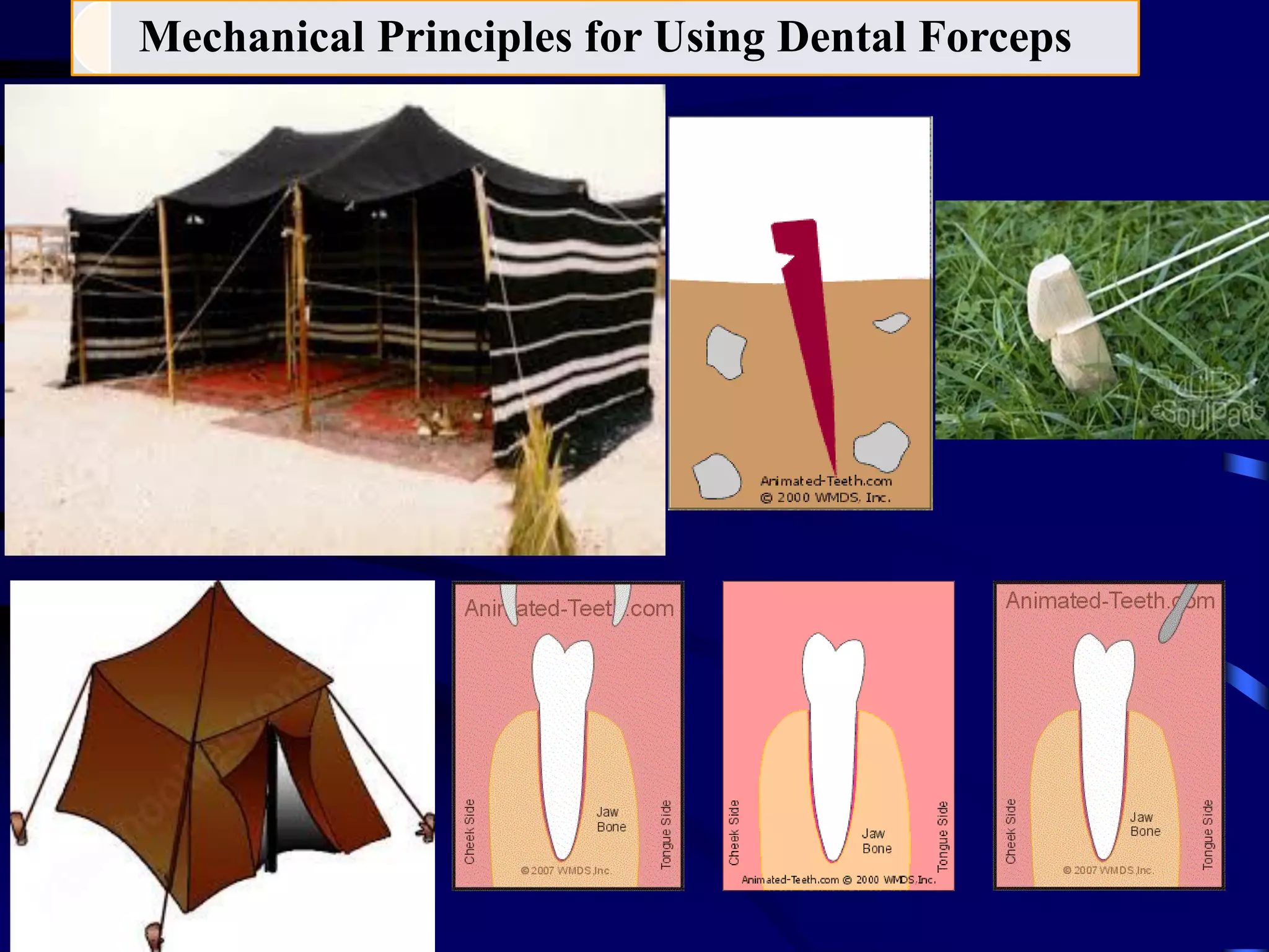Principles of Exodontia (teeth extraction) by Dr., Giath Gazal, 2020 | PDF