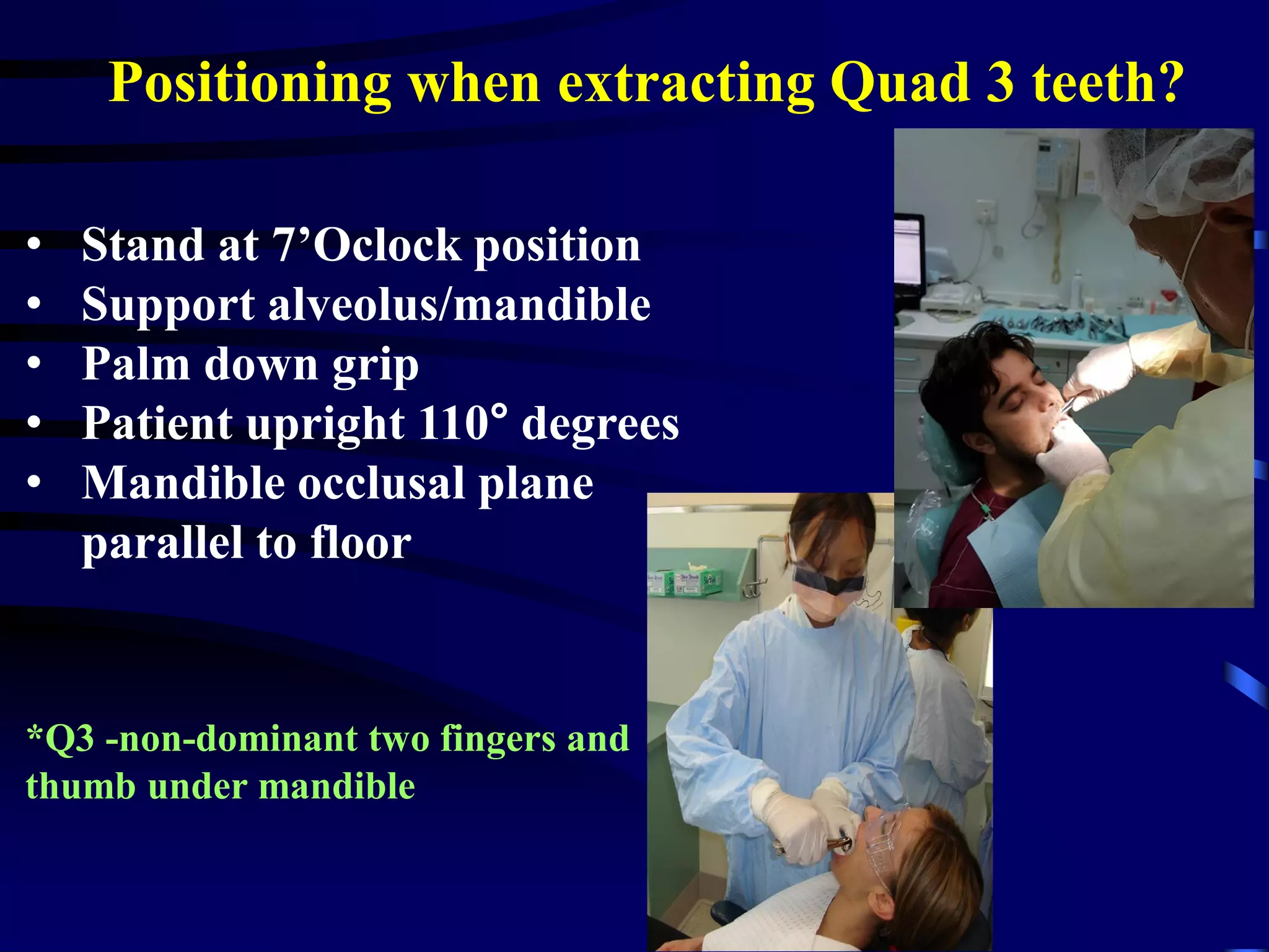 Principles of Exodontia (teeth extraction) by Dr., Giath Gazal, 2020 | PDF