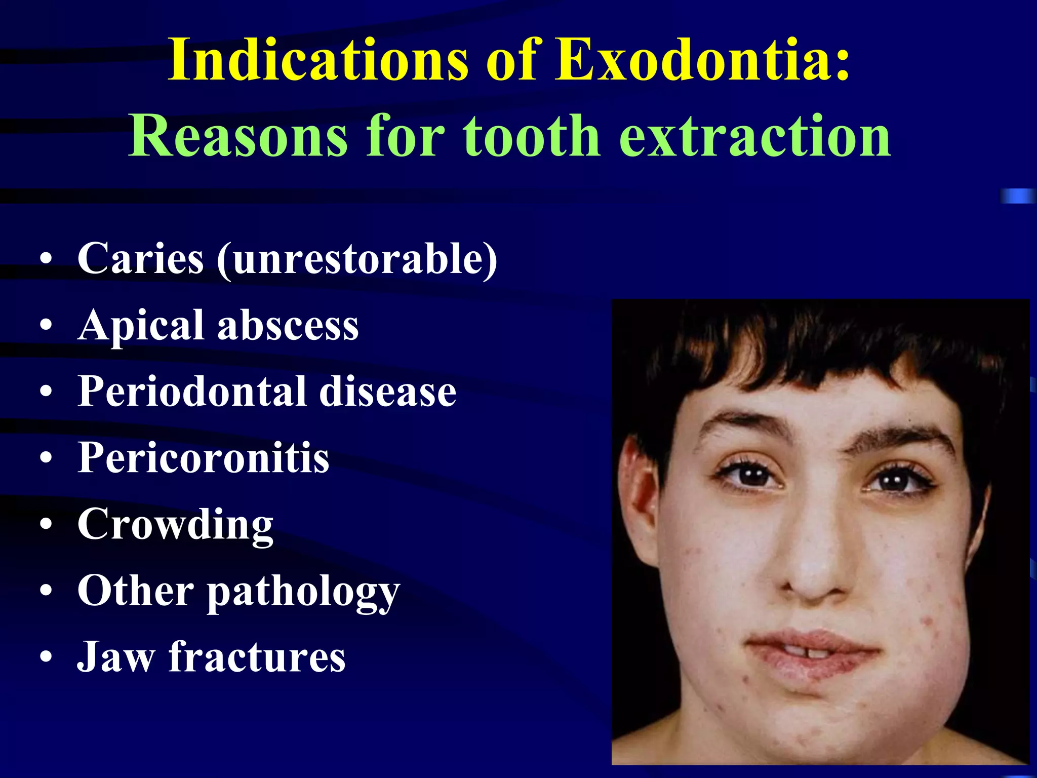 Principles of Exodontia (teeth extraction) by Dr., Giath Gazal, 2020 | PDF