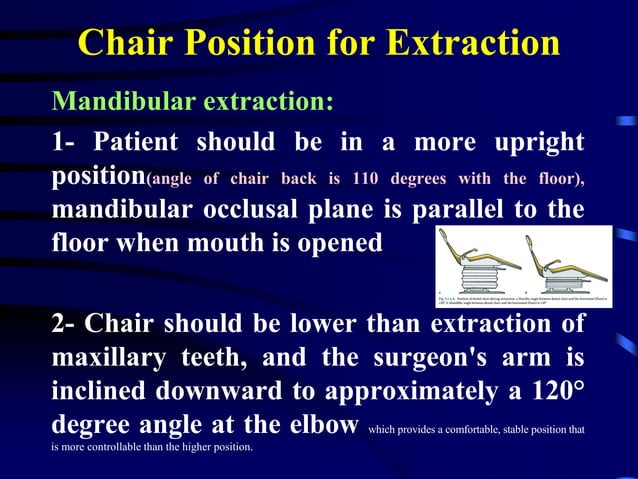 Principles of Exodontia (teeth extraction) by Dr., Giath Gazal, 2020 | PPT