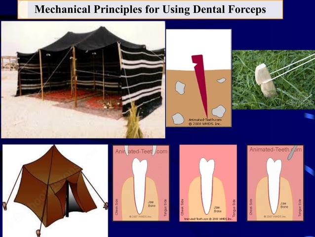 Principles of Exodontia (teeth extraction) by Dr., Giath Gazal, 2020 | PPT