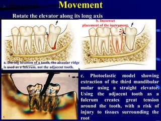 Principles of Exodontia (teeth extraction) by Dr., Giath Gazal, 2020 | PDF