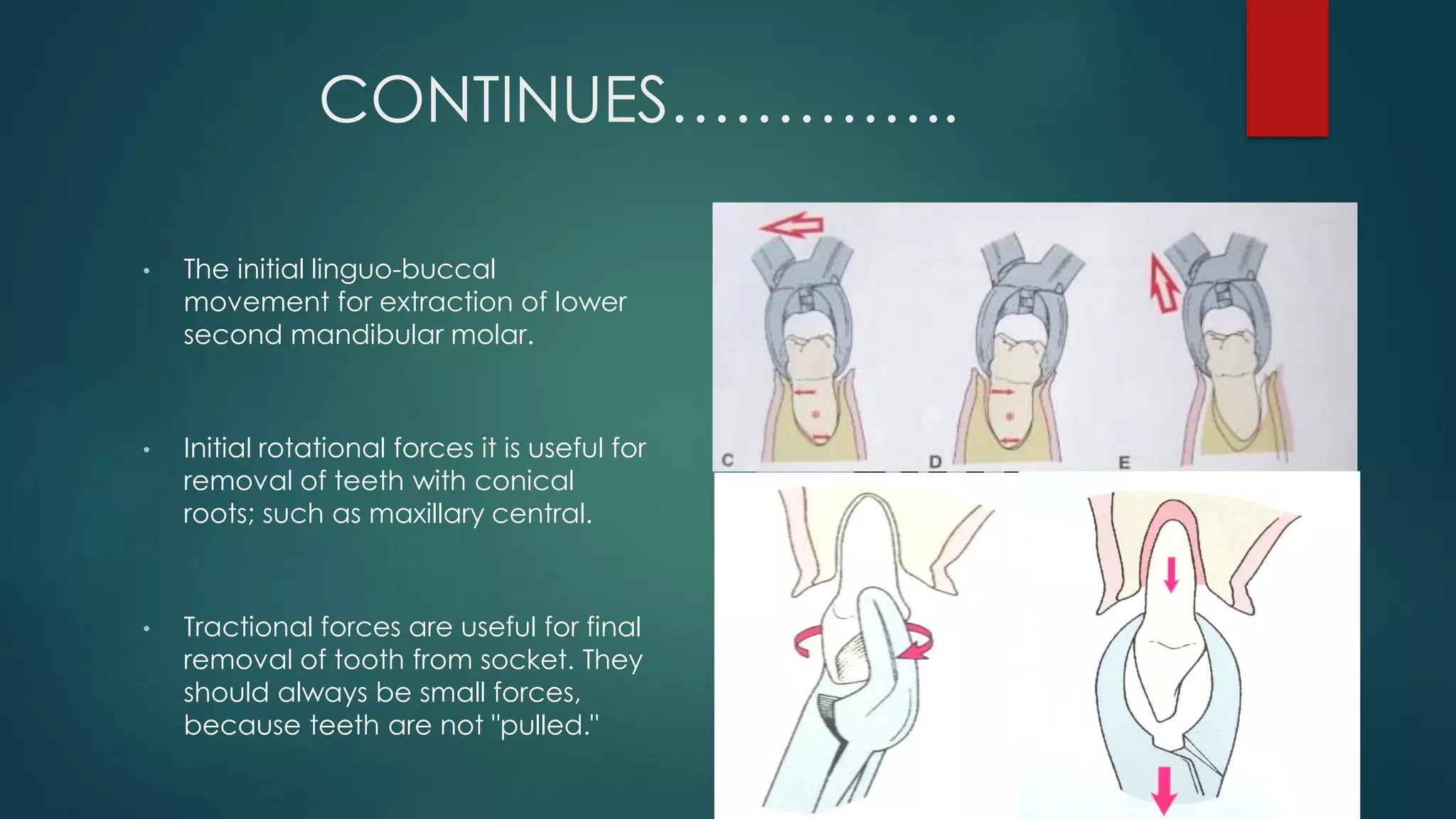 Exodontia Principles and Techniques | PDF